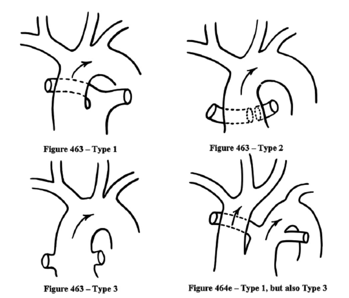 Pediatric Cardiology : Truncus Arteriosus : Truncus Arteriosus ...