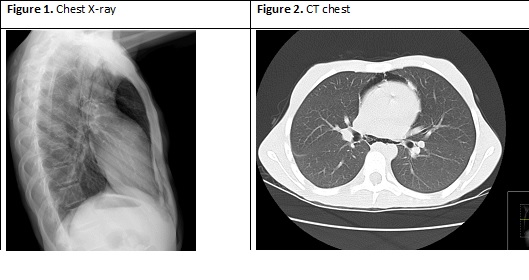Hydrocephalus Imaging: Diseases and Conditions | Pediatric Oncall
