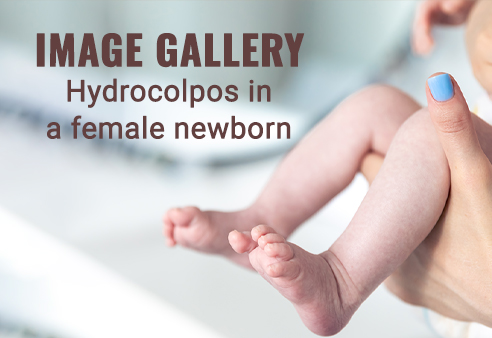 Pediatric Oncall - Child health medical Information website on pediatrics